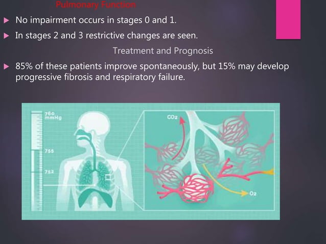 interstitial lung disease (ilD) | PPT | Lung and Respiratory Health ...