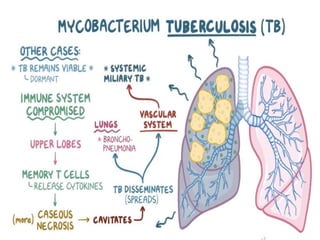 Tuberculosis | PPTX