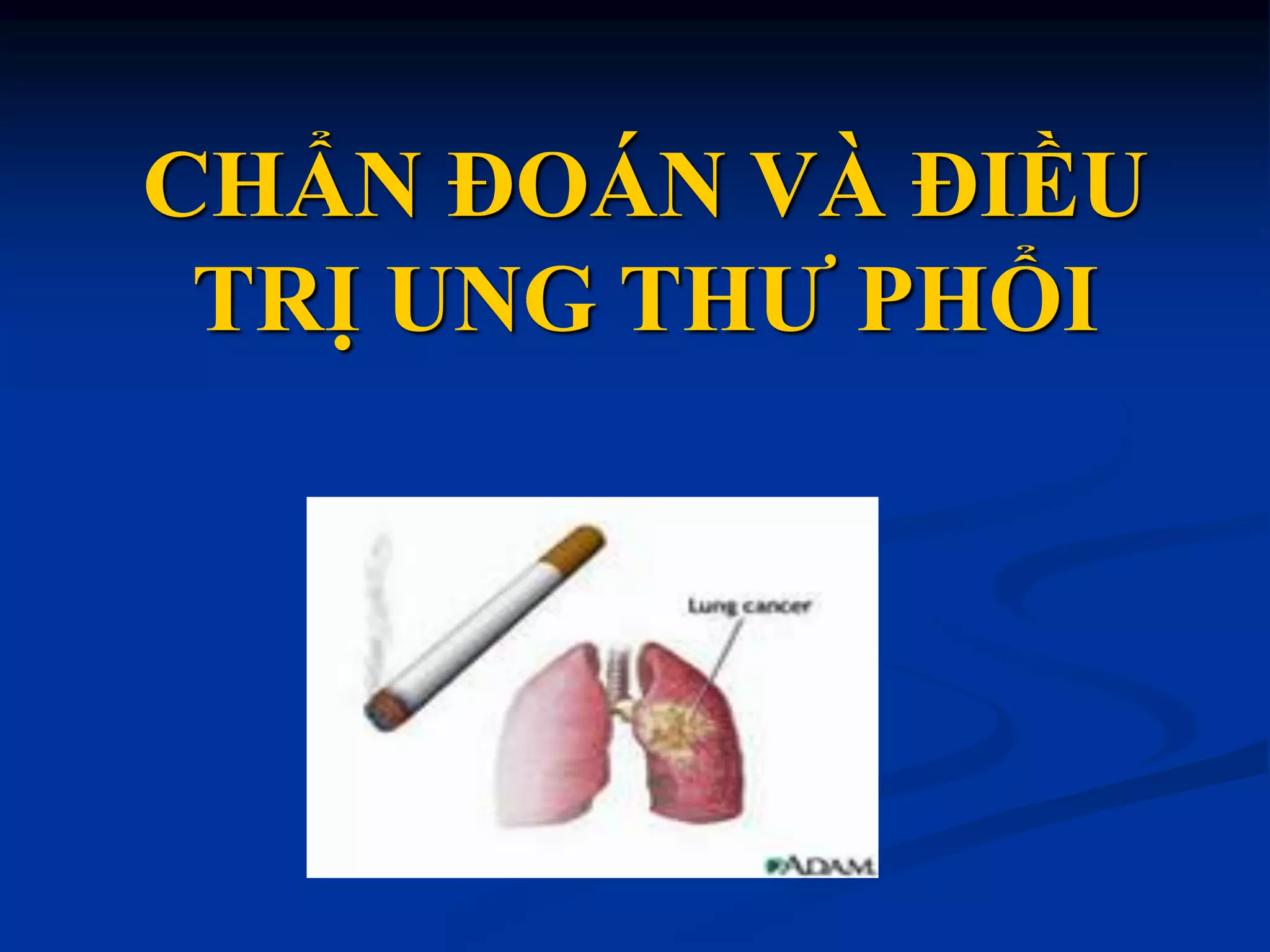 CHẨN ĐOÁN VÀ ĐIỀU TRỊ UNG THƯ PHỔI | PDF