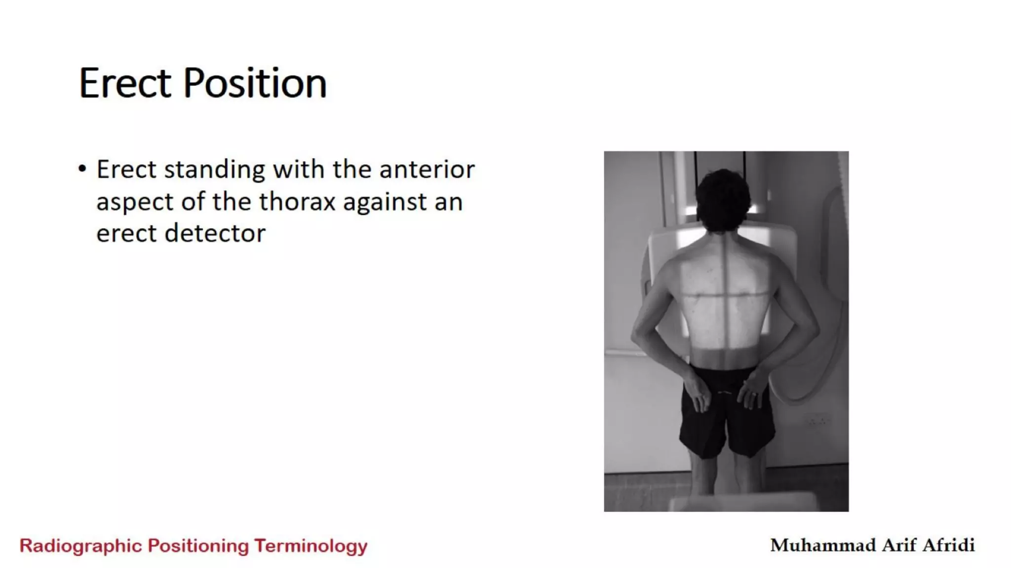 Radiographic positioning terminology | PDF
