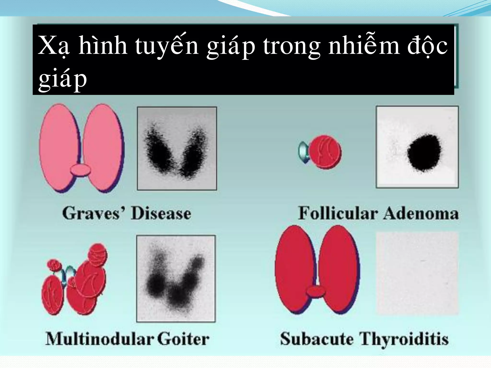 HỘI CHỨNG NHIỄM ĐỘC GIÁP ( CƯỜNG GIÁP) | PDF
