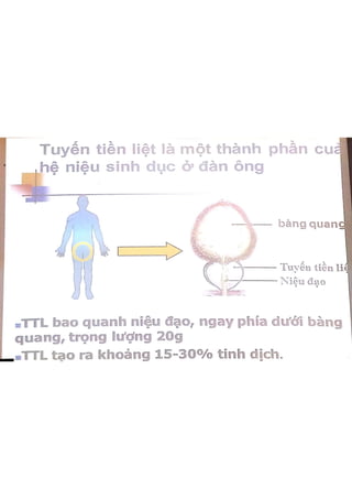 U PHÌ ĐẠI TUYẾN TIỀN LIỆT | PDF