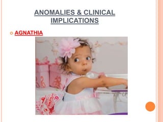 POST NATAL GROWTH AND DEVELOPMENT OF MAXILLA AND MANDIBLE | PPTX