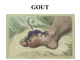 Gout-The King of diseases & the disease of Kings | PPT