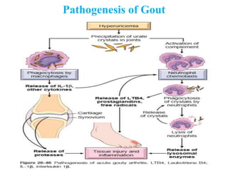 Gout-The King of diseases & the disease of Kings | PPT