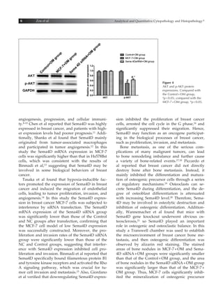 Role of Sema4D in Bone Metastasis of Breast Cancer | PDF