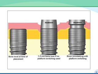 PLATFORM SWITCHING | PPTX