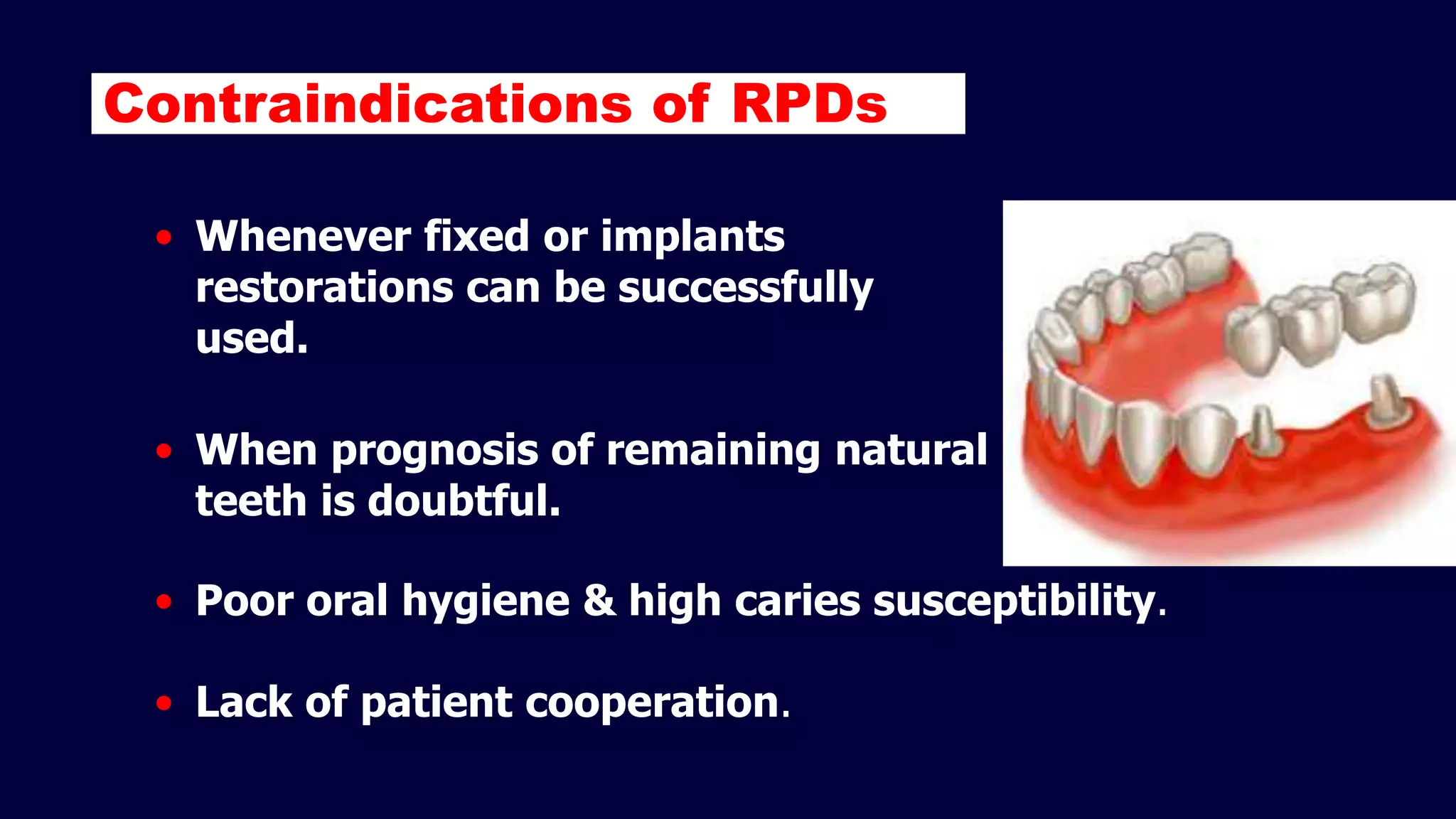 1. Introduction and forces acting on Removable Partial Denture (RPD). | PPT