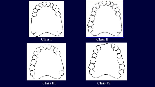 1. Introduction and forces acting on Removable Partial Denture (RPD). | PPT