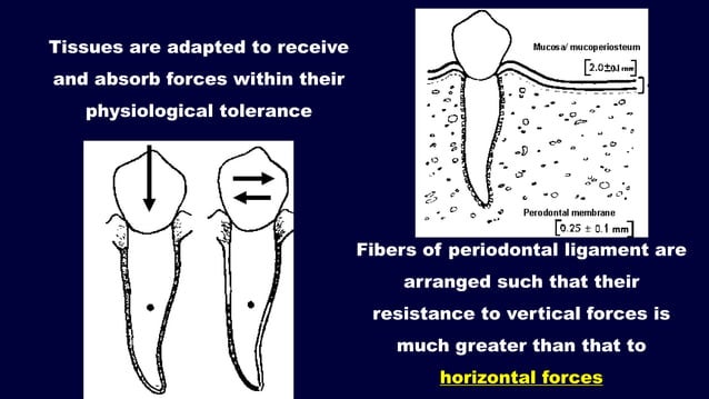 1. Introduction and forces acting on Removable Partial Denture (RPD). | PPT