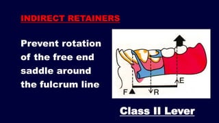 1. Introduction and forces acting on Removable Partial Denture (RPD ...