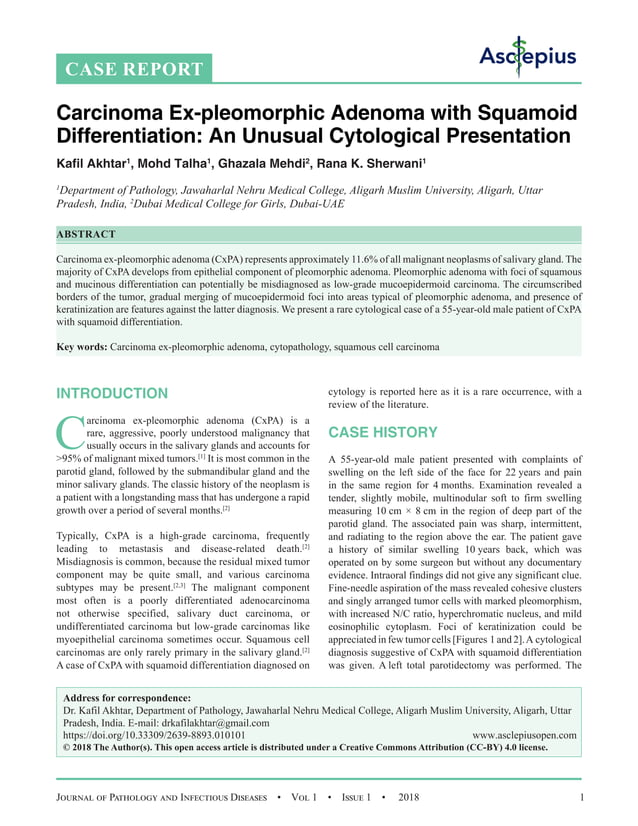 Carcinoma Ex-pleomorphic Adenoma with Squamoid Differentiation: An ...