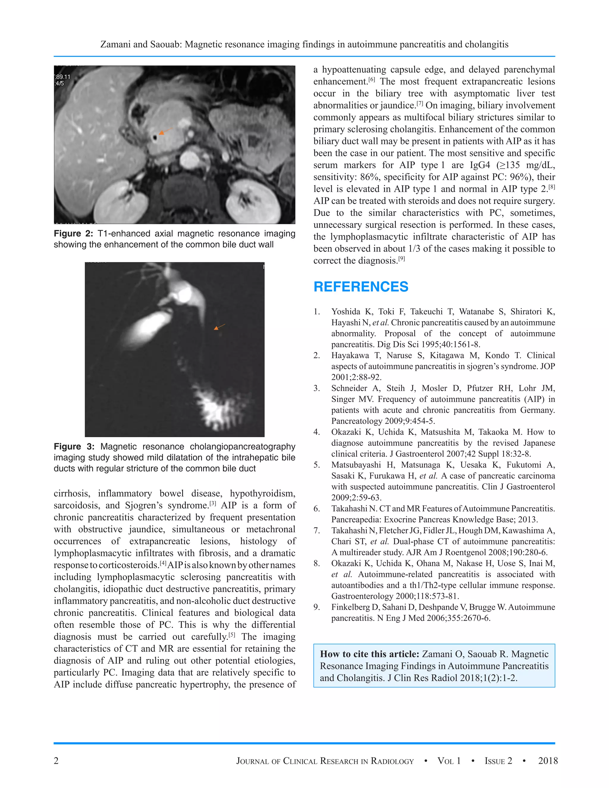 Magnetic Resonance Imaging Findings in Autoimmune Pancreatitis and ...