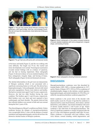 Clinical and Radiological Diagnosis of Hurler–Scheie Syndrome | PDF