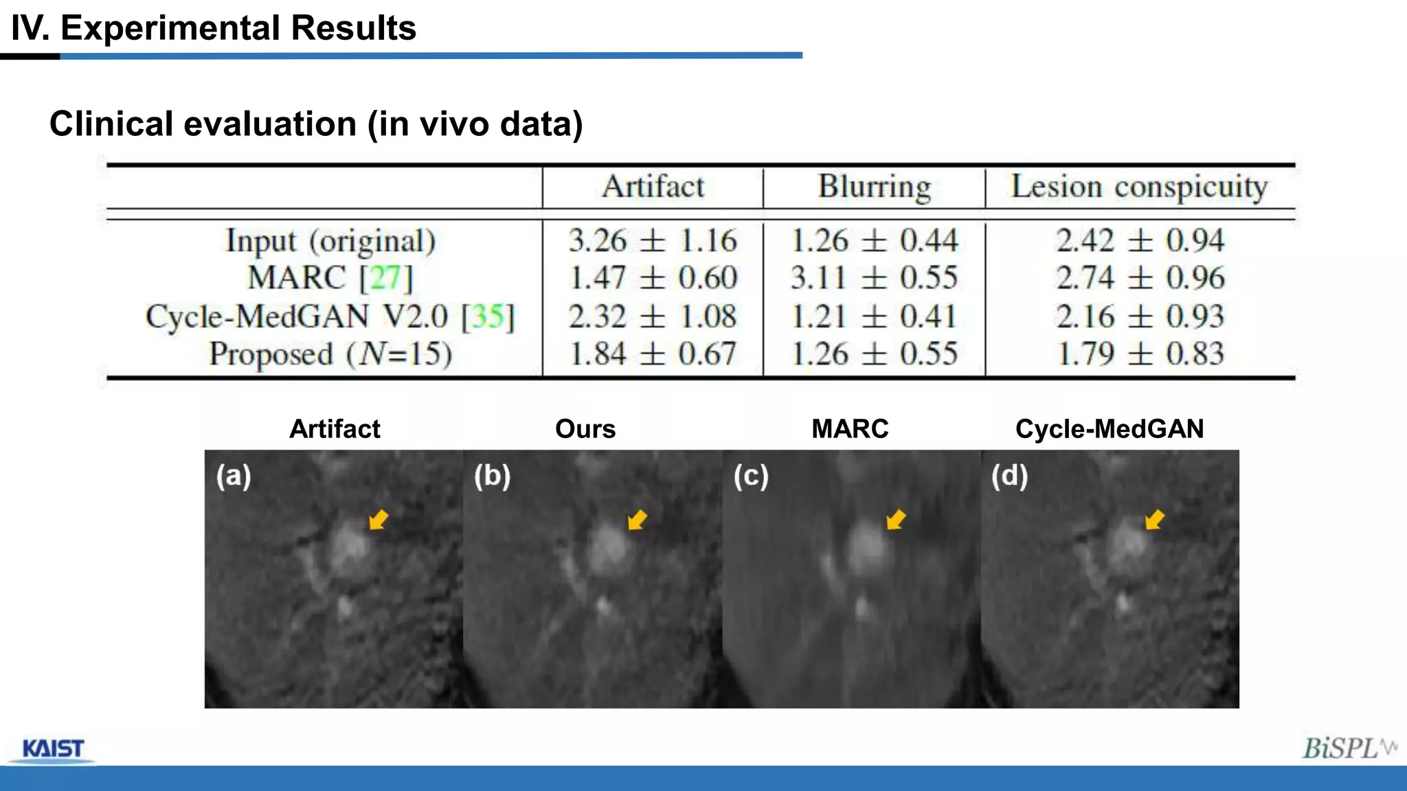 Unpaired Mr Motion Artifact Deep Learning Using Outlier Rejecting Bootstrap Aggregation Ppt