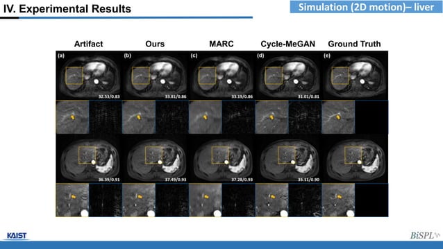 Unpaired Mr Motion Artifact Deep Learning Using Outlier Rejecting Bootstrap Aggregation Ppt