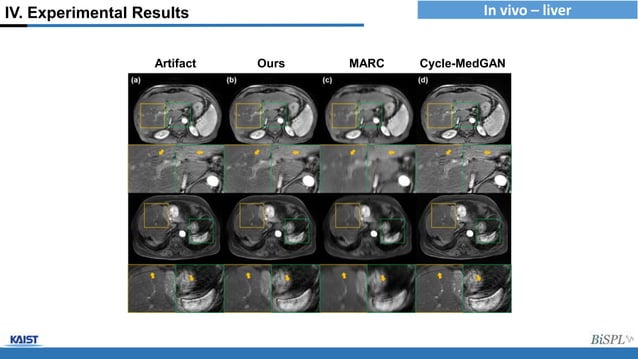 Unpaired Mr Motion Artifact Deep Learning Using Outlier Rejecting Bootstrap Aggregation Ppt