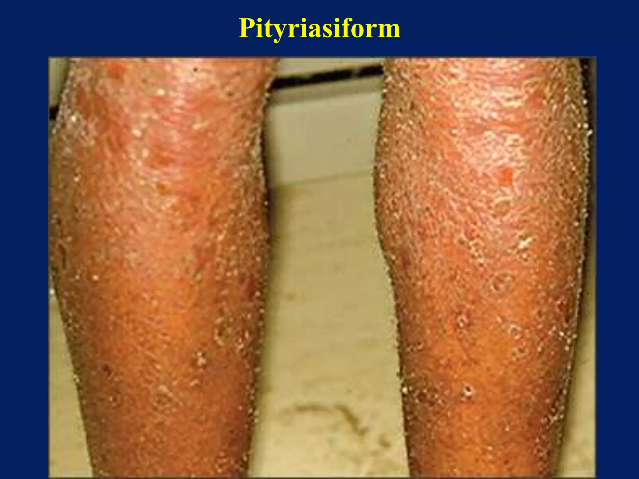 Skin terminologies.ppt