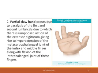 1. MEDIAN NEUROPATHY.pdf