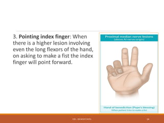 1. MEDIAN NEUROPATHY.pdf