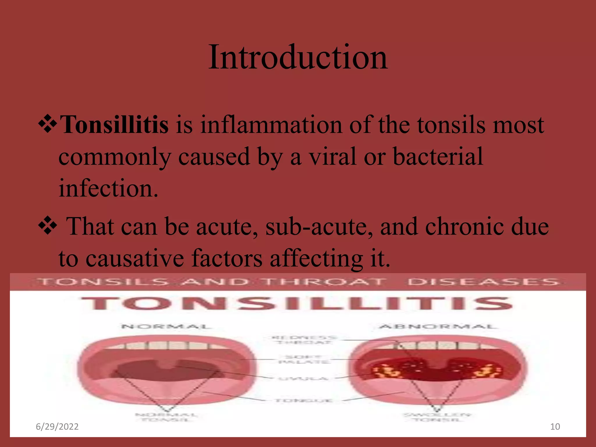 Tonsilitis | PPTX