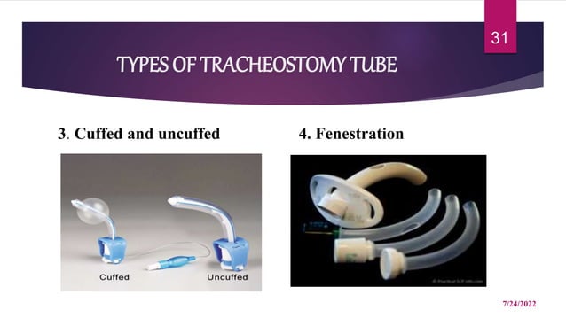 Tracheostomy care (Adult) | PPTX | Ear, Nose and Throat Conditions ...