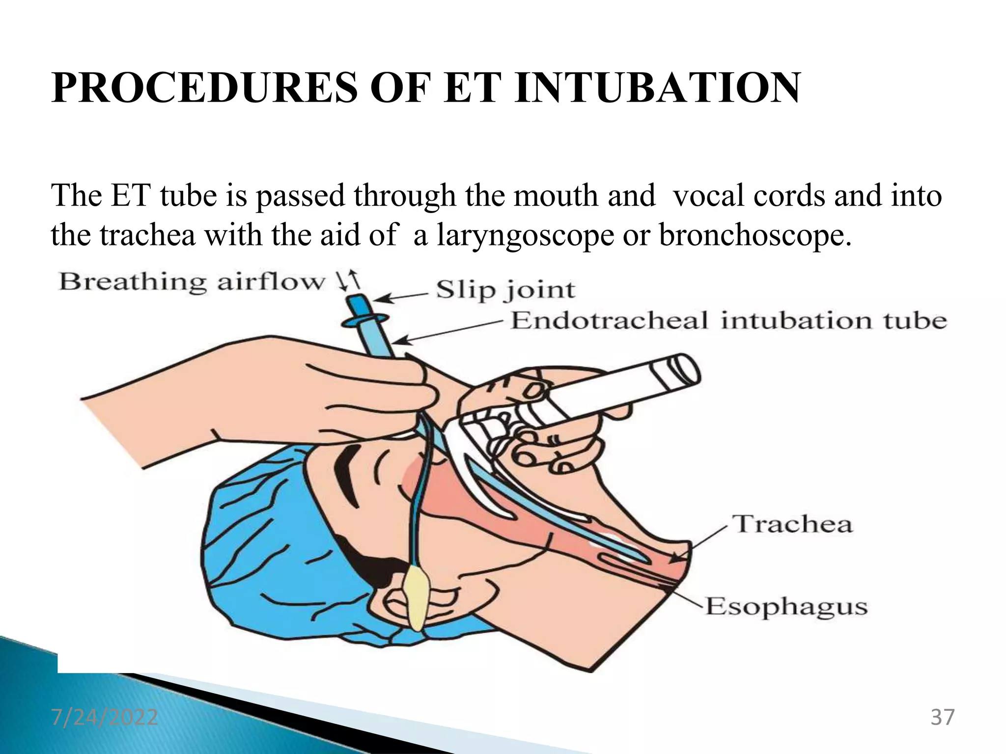 ET TUBE intubation | PPTX