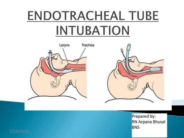ET TUBE intubation | PPTX | First Aid | Injuries