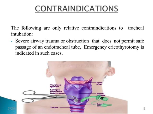 ET TUBE intubation | PPTX | First Aid | Injuries