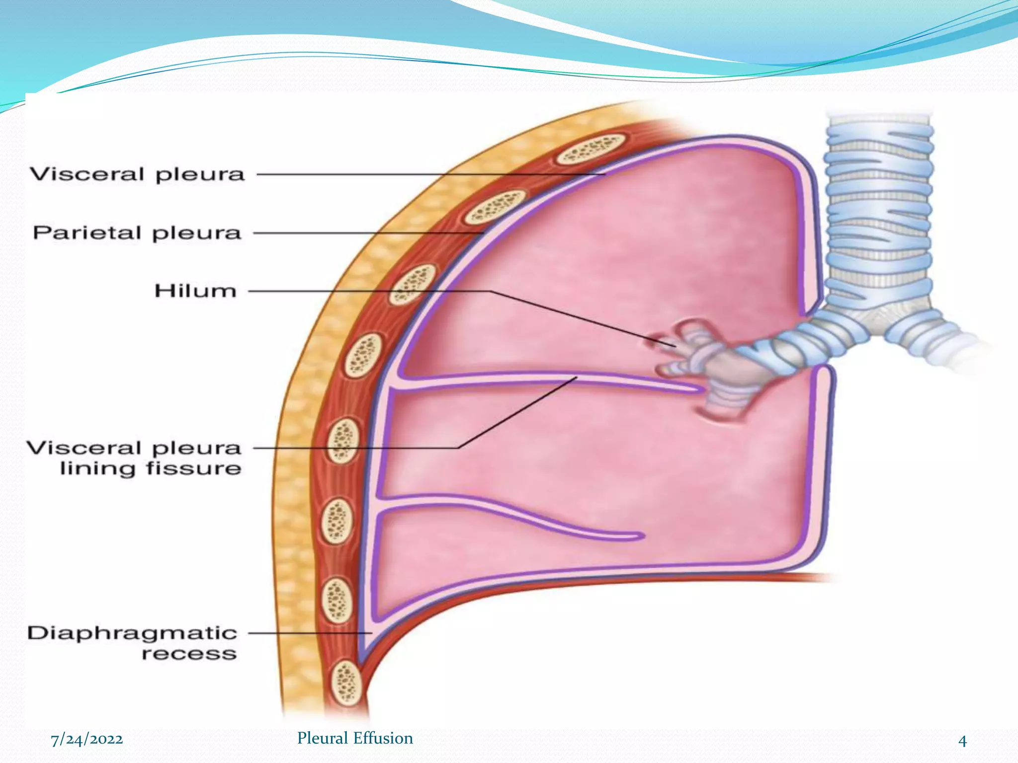 pleural effusion | PPT