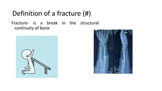 Fractures: Definiton, Diagnosis, Fracture healing , Complications.pptx