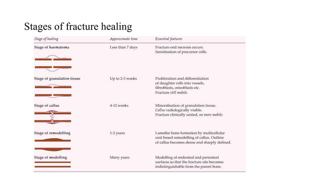 Fractures: Definiton, Diagnosis, Fracture healing , Complications.pptx