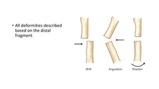Fractures: Definiton, Diagnosis, Fracture healing , Complications.pptx