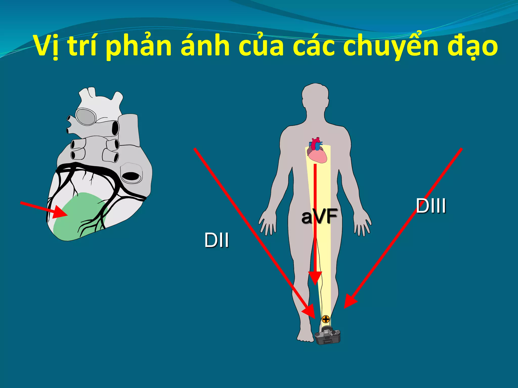 1. Tiếp cận ECG.pptx