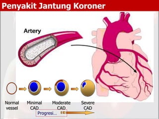 1. PJK dan Pencegahannya.ppt