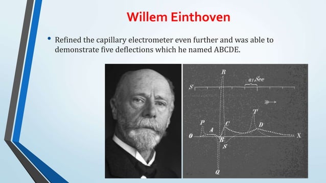 HISTORY EVOLUTION OF ECG.pptx