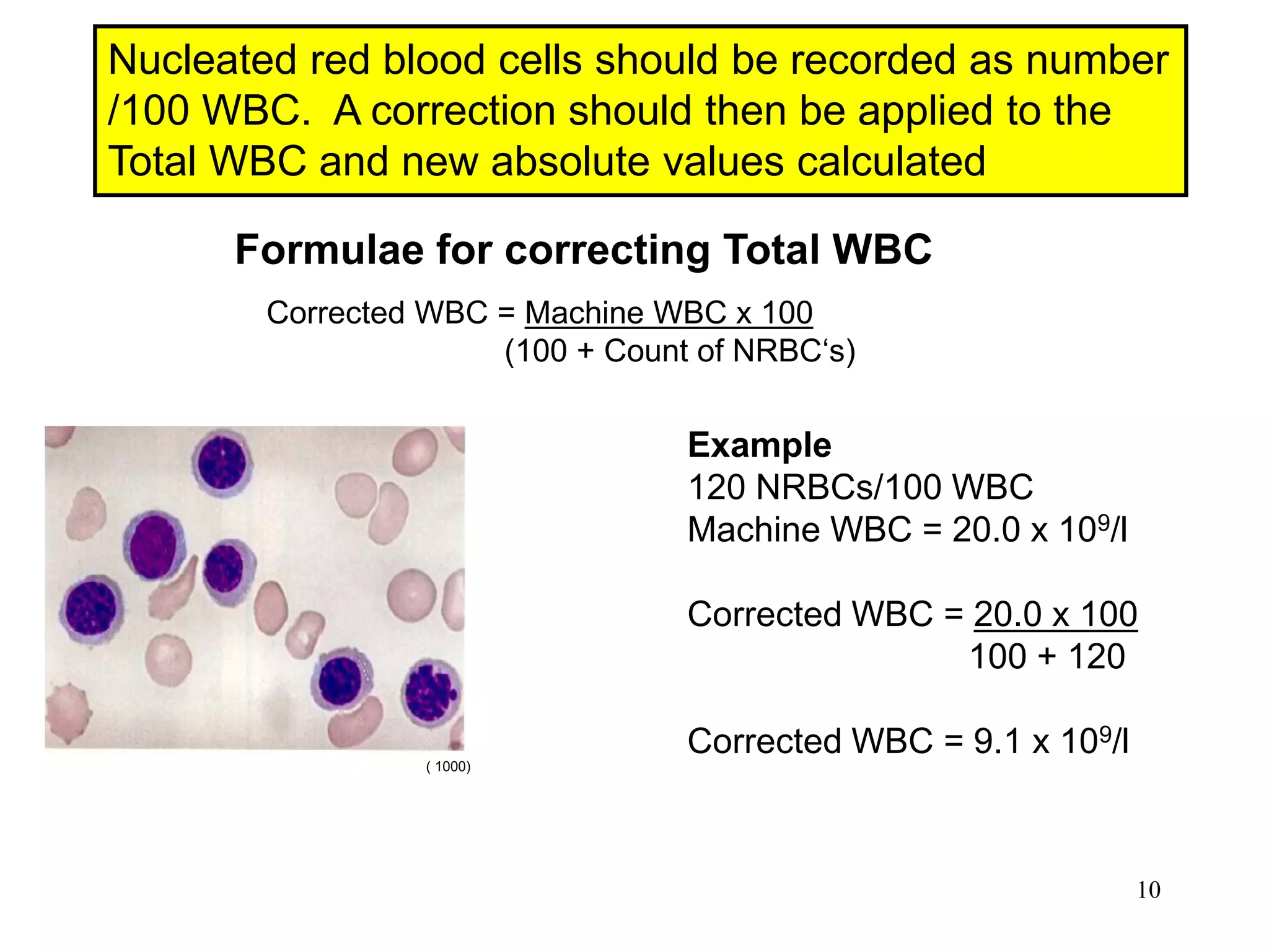 1. Leucopoiesis - myeloid.ppt