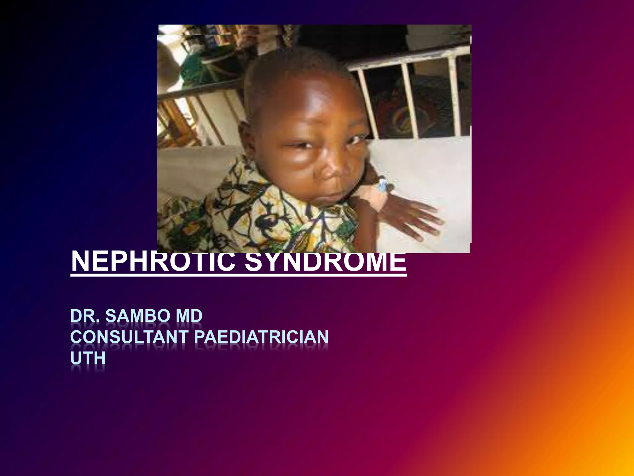 Nephrotic Syndrome Guide | PPT