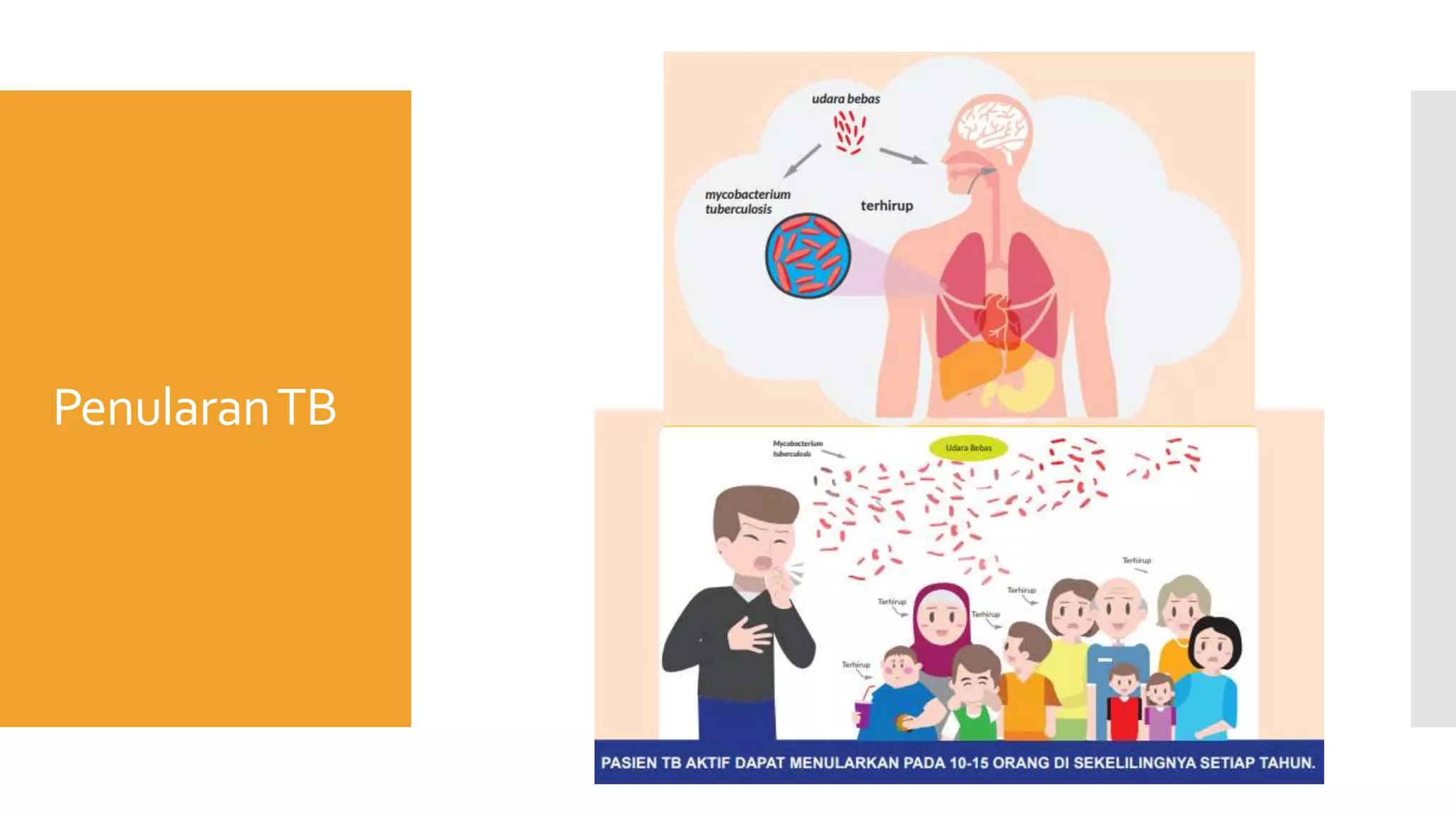 1. Strategi Penemuan Terduga TB.ppt