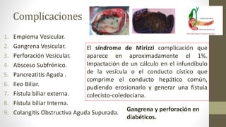 1.- Colecistitis y Piocolecisto.pptx