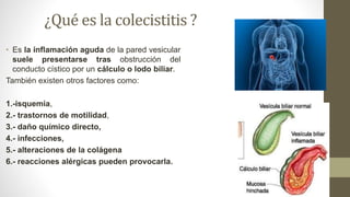 1.- Colecistitis y Piocolecisto.pptx