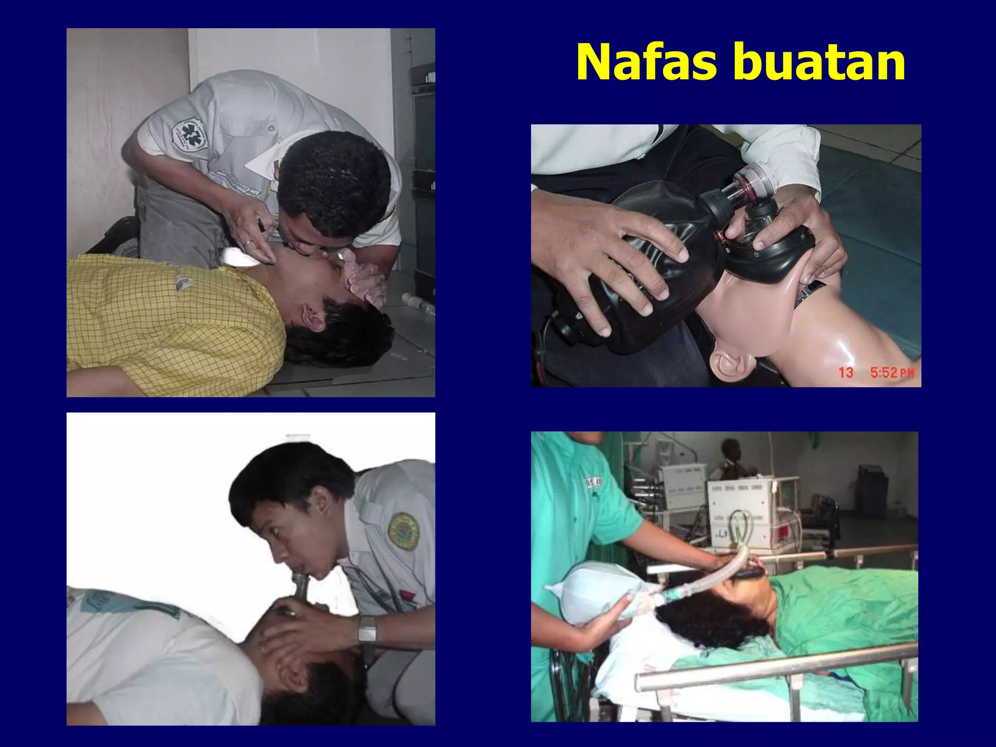 1. BLS Brigjen TNI dr. Hasyim.pptx