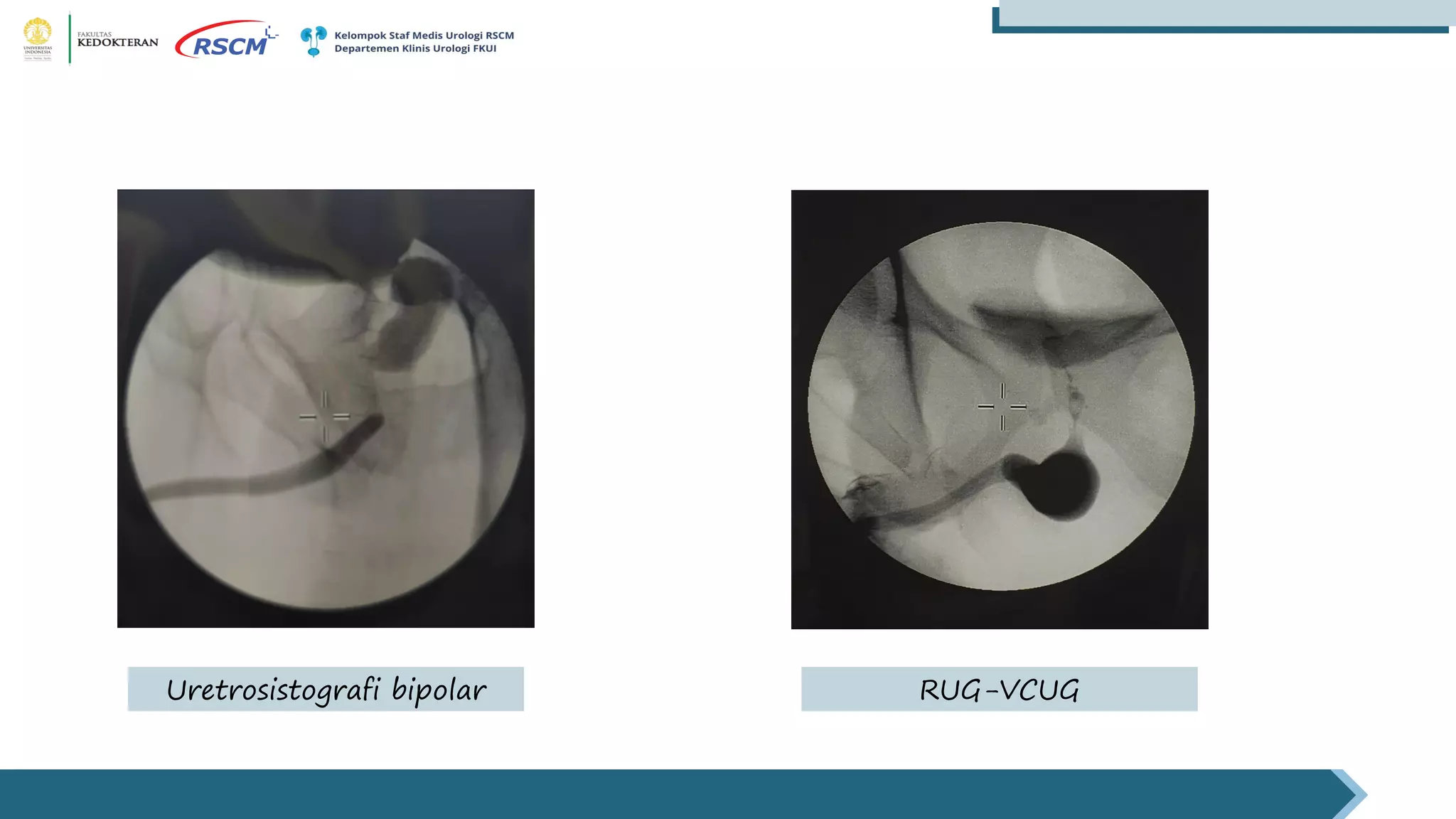 1. dr. Gampo Alam, SpU (K) - Penatalaksanaan Peri Operatif Pada ...