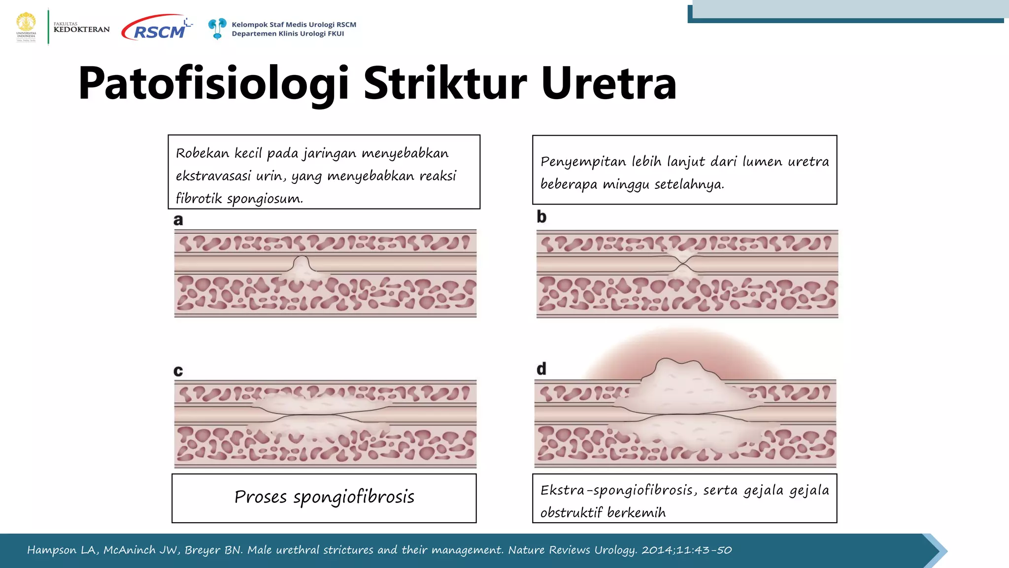 1. dr. Gampo Alam, SpU (K) - Penatalaksanaan Peri Operatif Pada ...