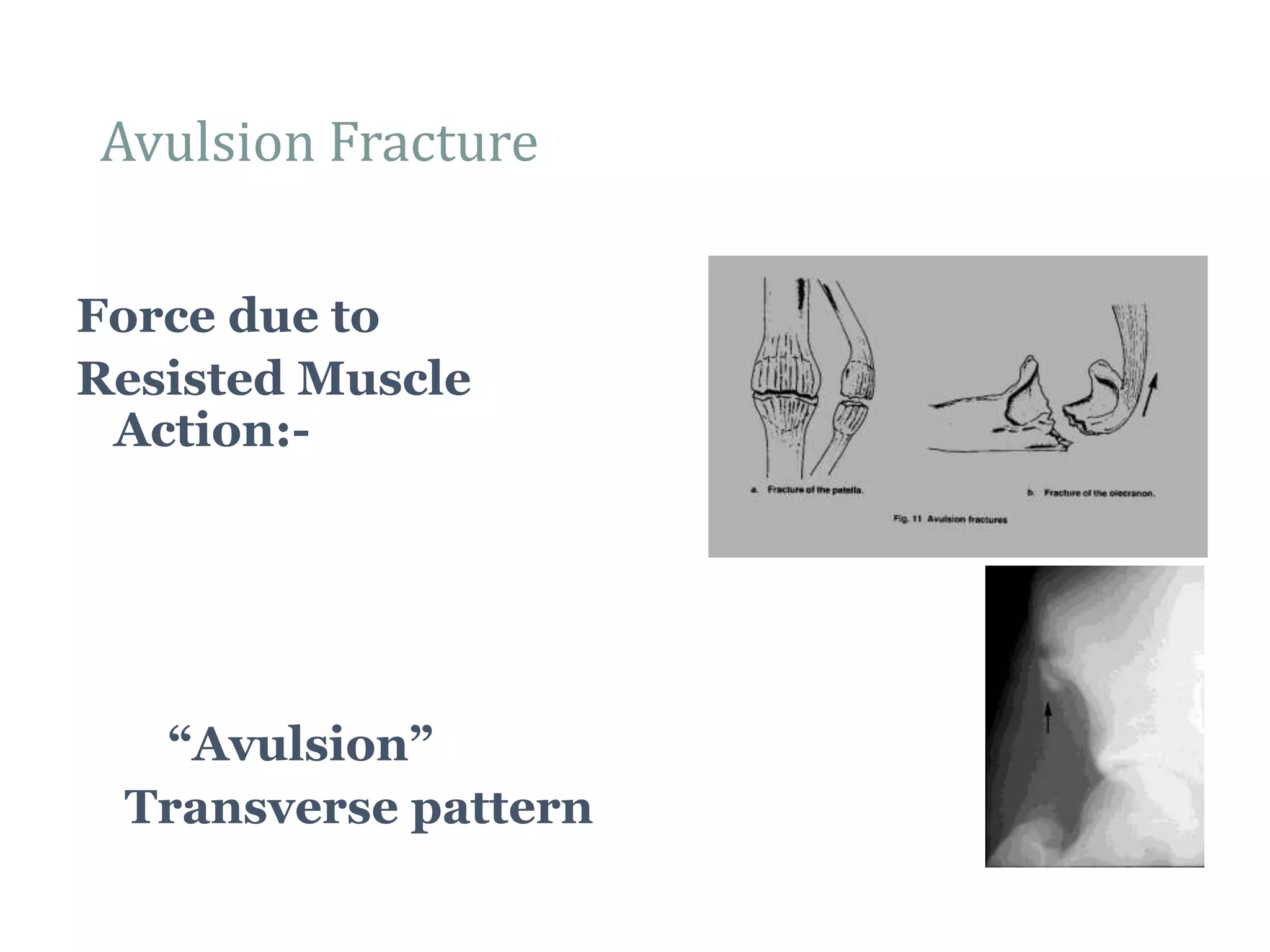 1. Introduction to Orthopaedics.ppt