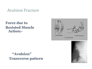 1. Introduction to Orthopaedics.ppt