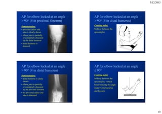 1. Upper Extremities.pdf