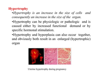 1.1 Basic principles of Cell injury.pptx
