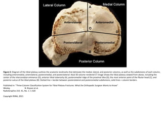 proximal tibia | PPTX | Death, Injury, or Military Conflict | Sensitive ...