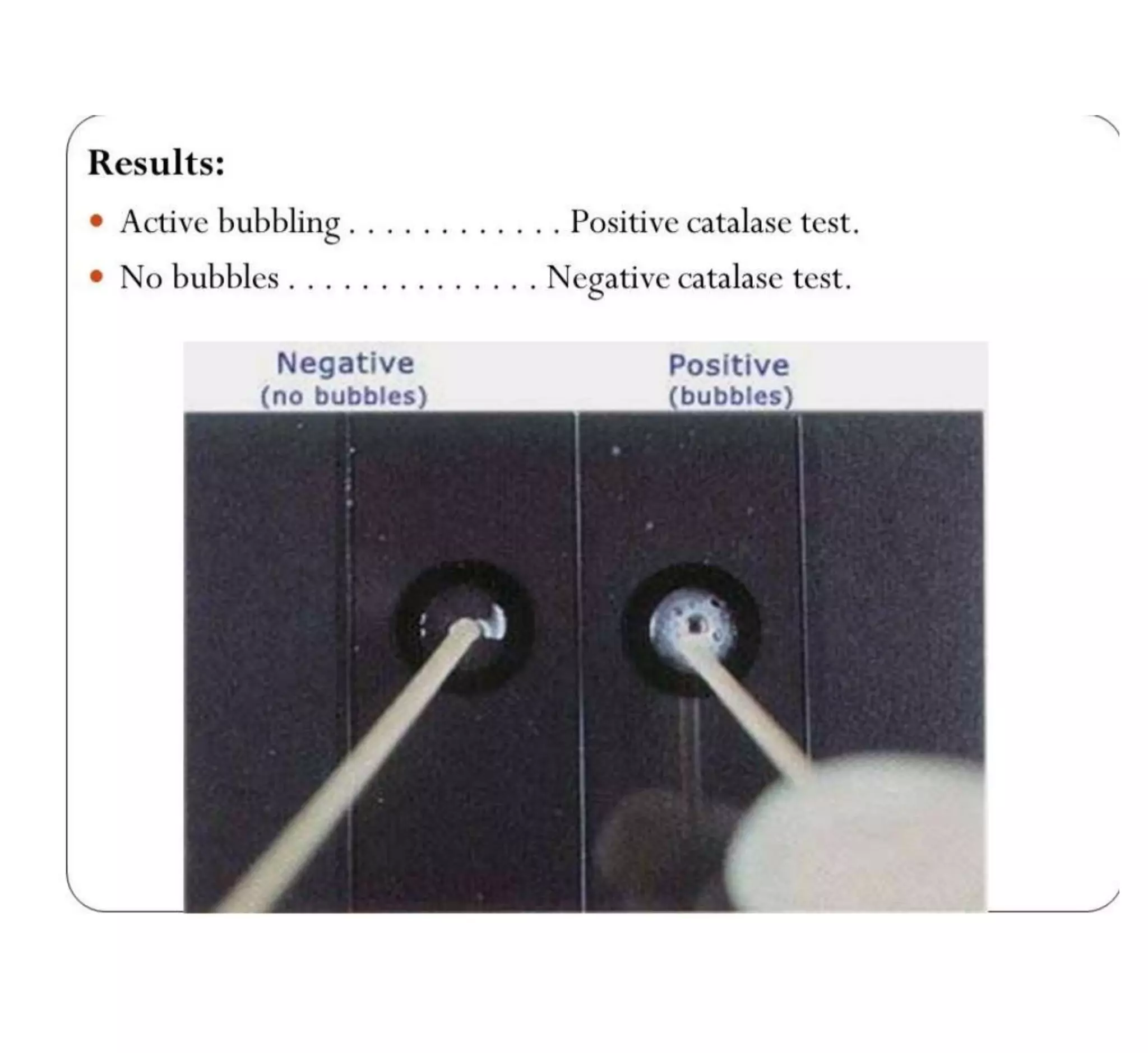1.Catalase,urease and TSI Test.pptx